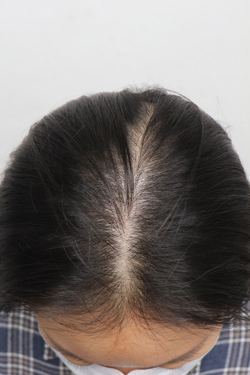 시술 - 머리하는별