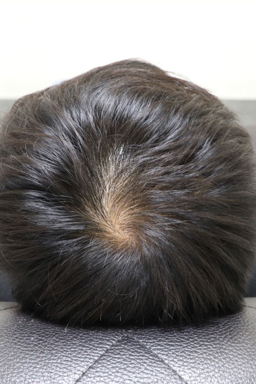 시술 - 머리하는별