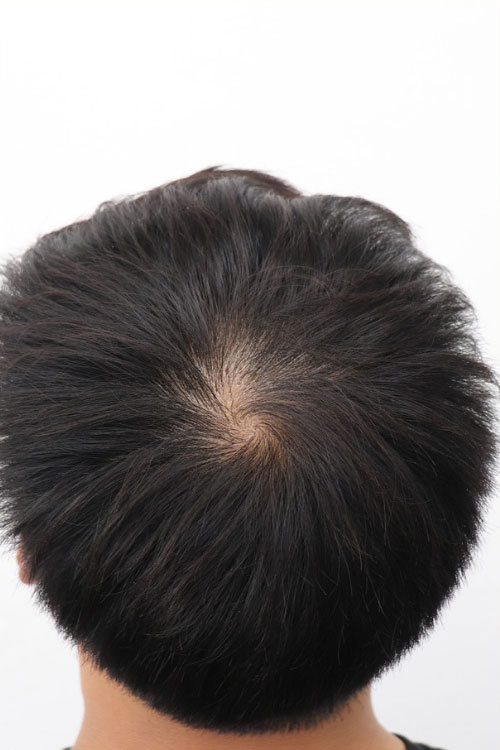 시술 - 머리하는별