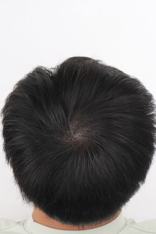 시술 - 머리하는별